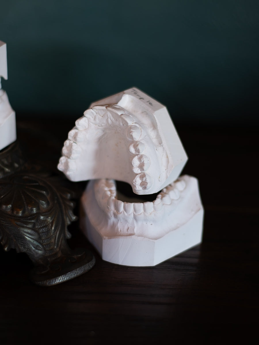 Vintage Dental Cast Model – Beloved Bones